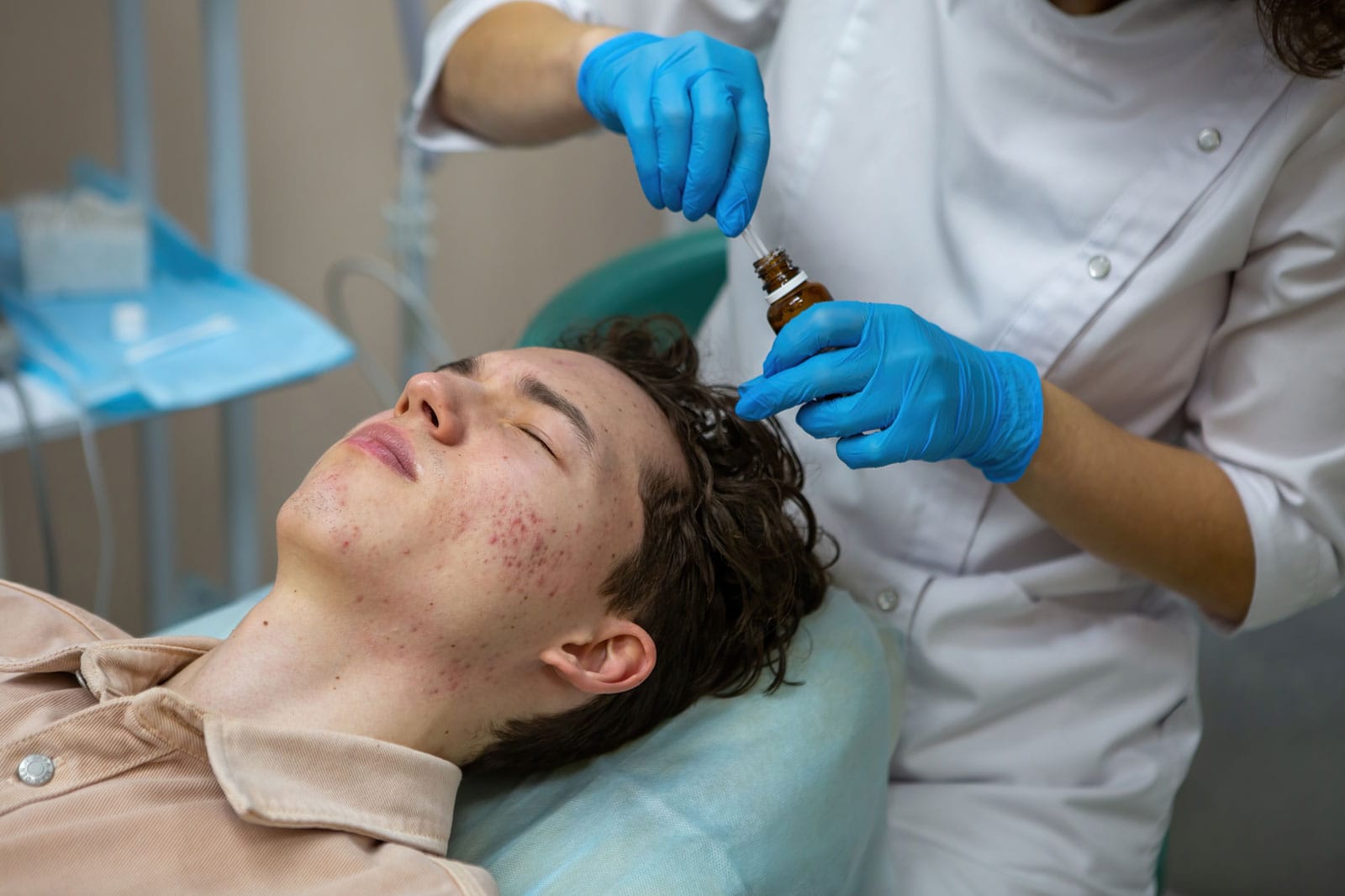 Acne e Cicatrizes: Tratamento Personalizado Clínica Leal Campinas