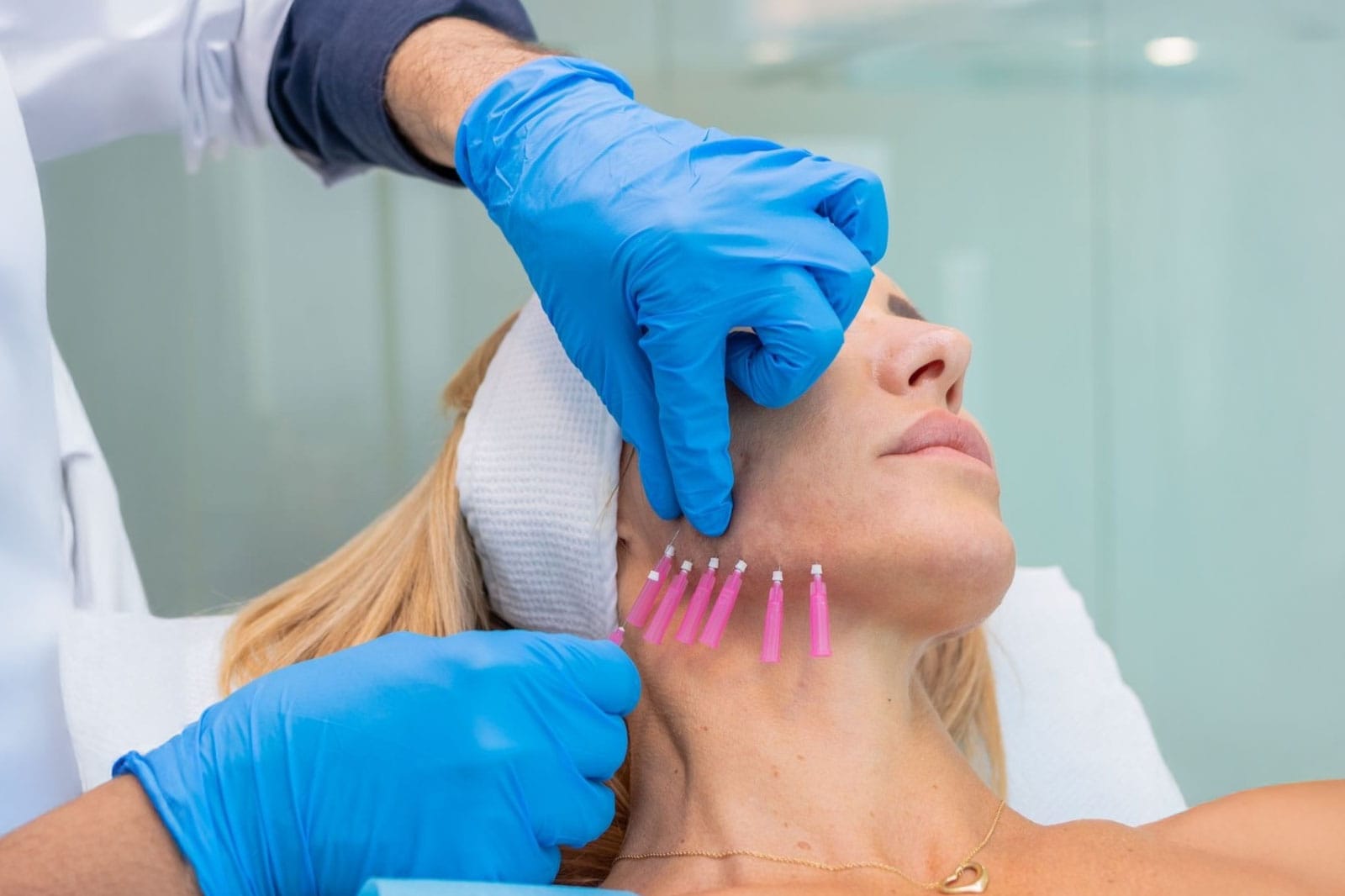 Fios de PDO em Campinas: Rejuvenescimento Facial Sem Cirurgia na ...